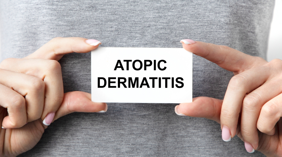 Innovative Treatments Reshaping Atopic Dermatitis Management